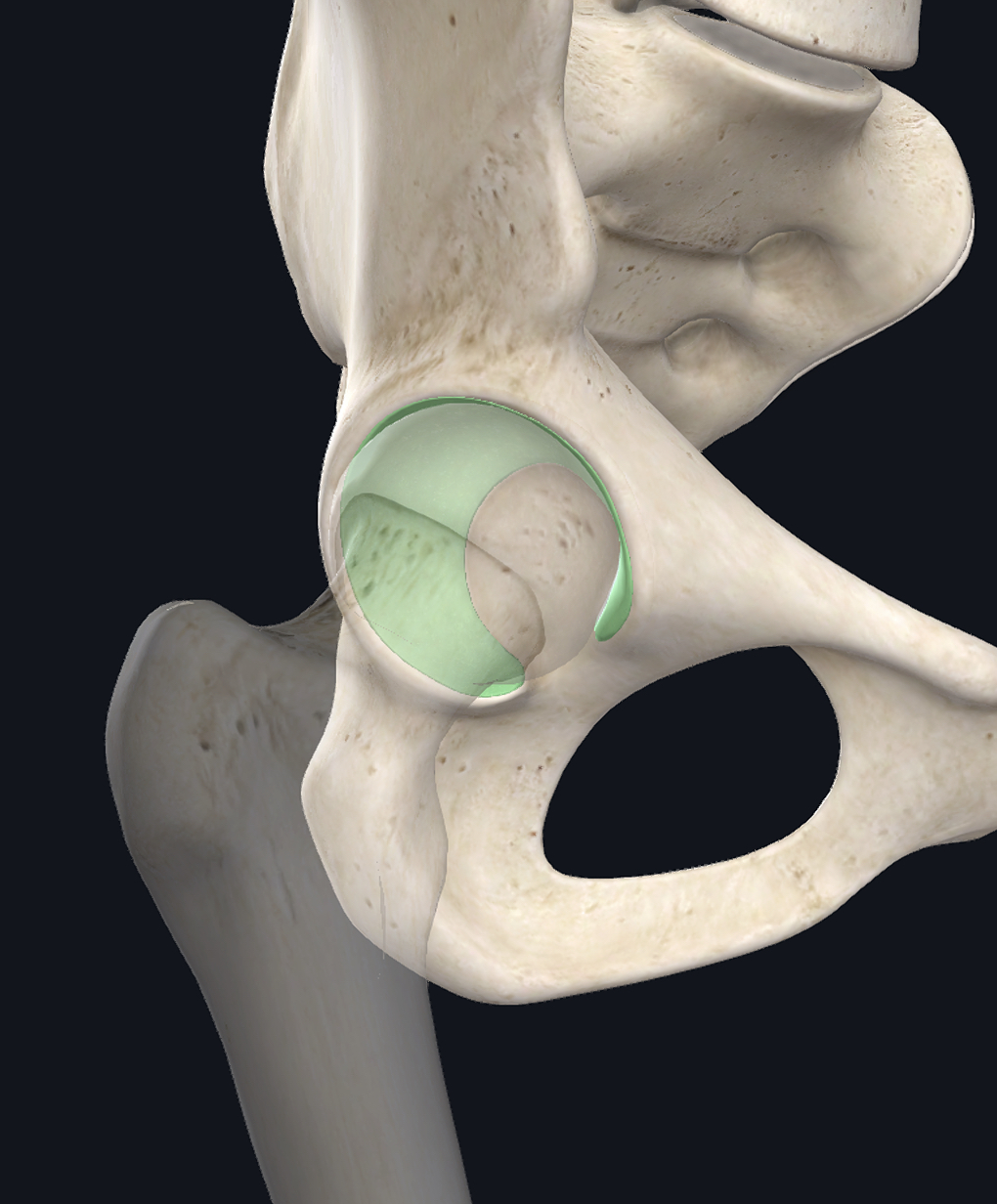 Hip Replacements: Partial vs. Total - Jaco Rehab