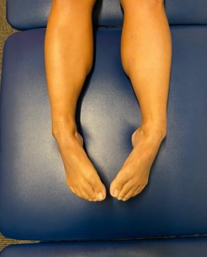 Ankle-Inversion - Jaco Rehab
